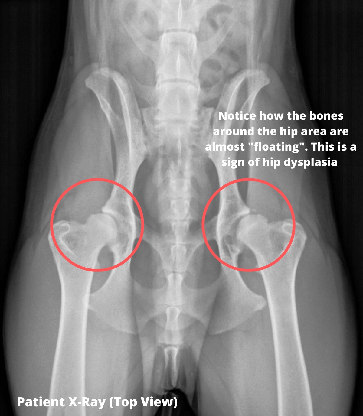 Dr. K's Case of the Month: These Hips Don't Lie